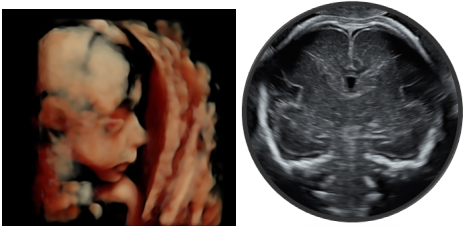 Antenatal Ultrasound Services